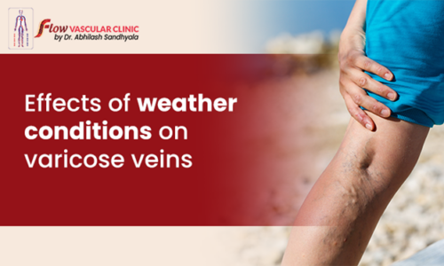 Effects of Weather Conditions on Varicose Veins | Dr Abhilash