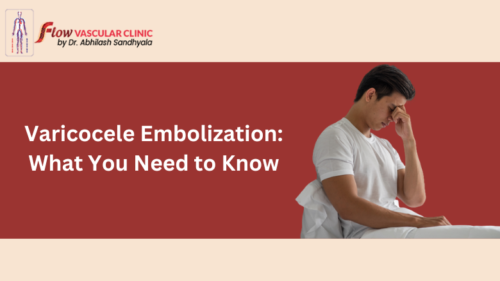 Varicocele Embolization: What You Need to Know | Dr Abhilash
